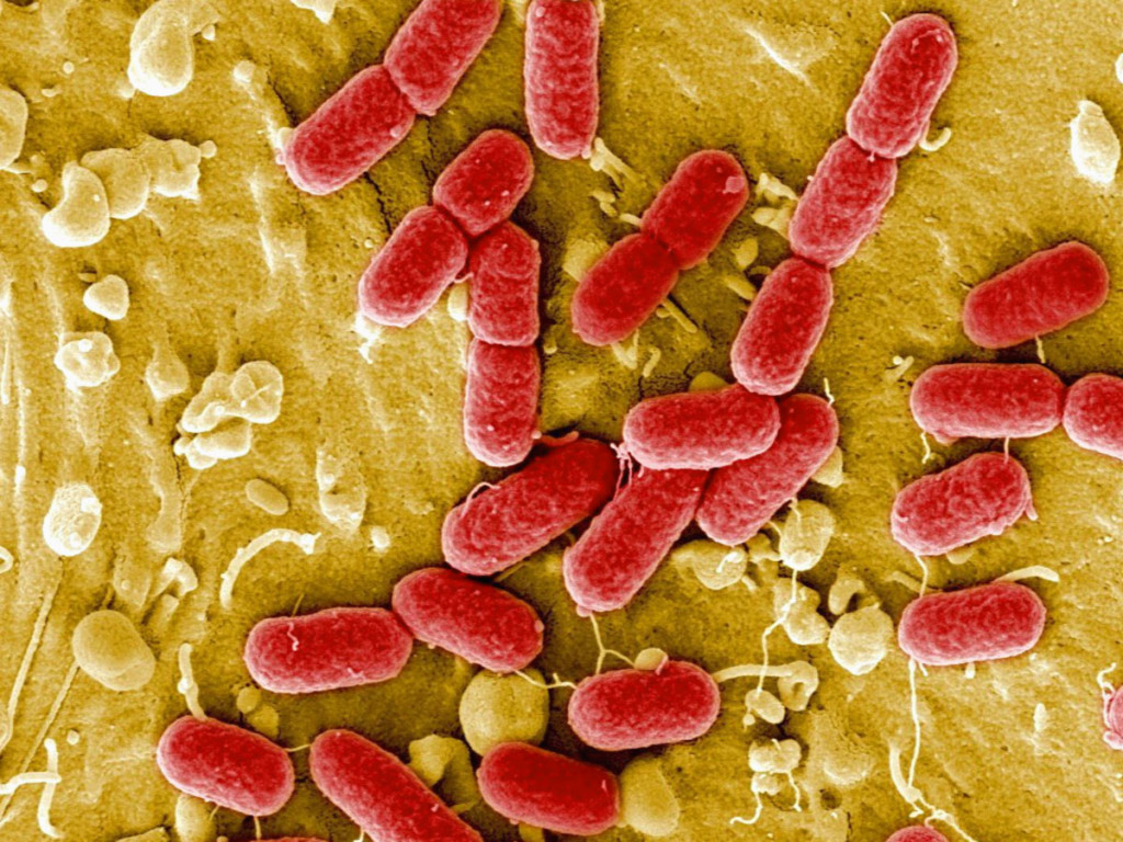 Virus e batteri: differenze. Usiamo correttamente questi termini Virus e batteri: differenze. Usiamo correttamente questi termini